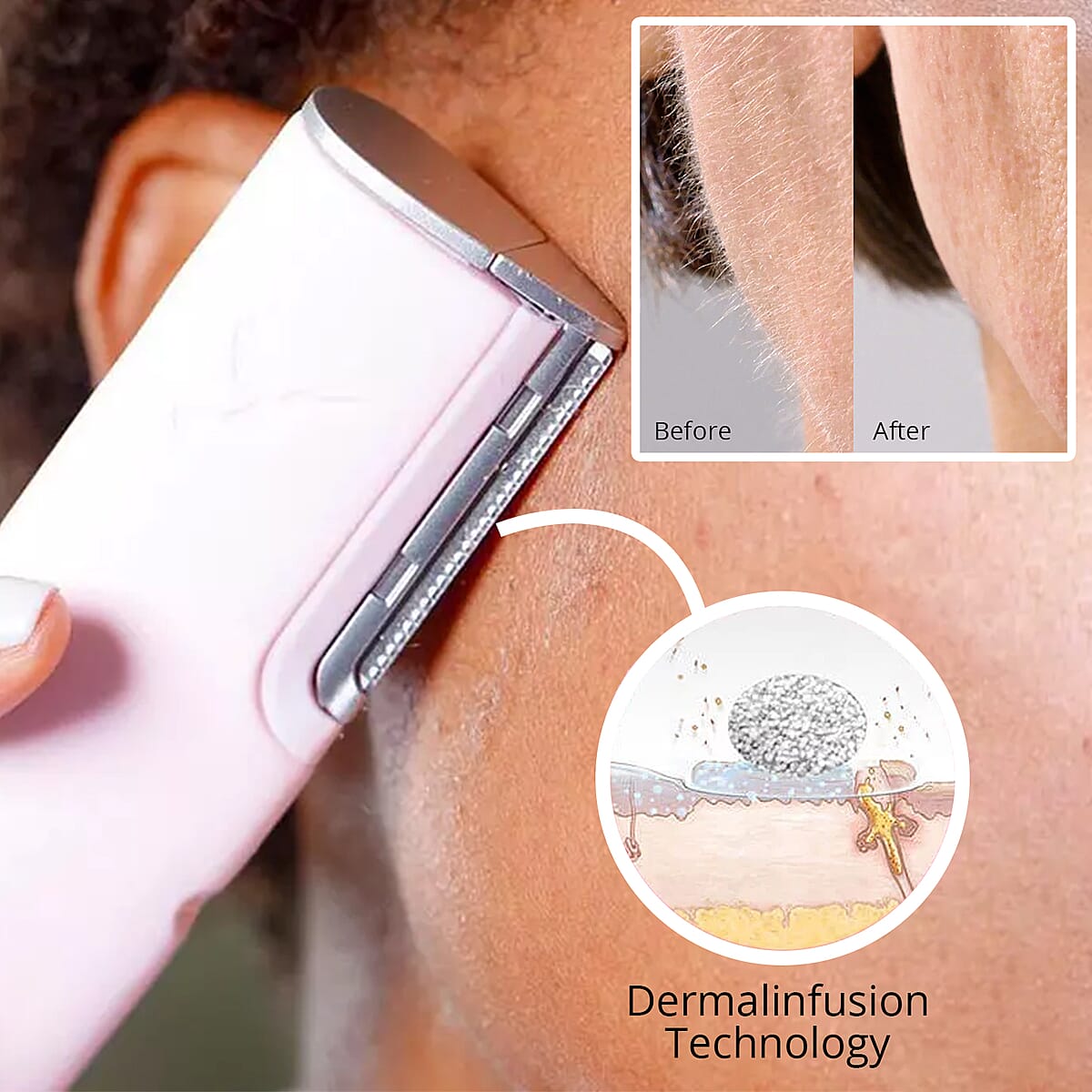 Buy Beautech Pink 2 in 1 Reusable Dermaplaning Tool at ShopLC.